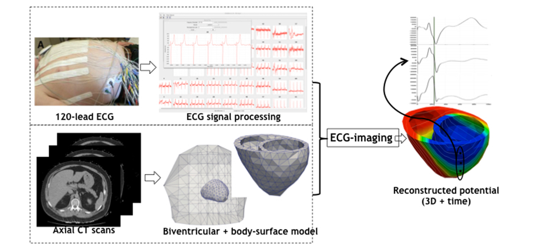 Electrocardiographic imaging (ECGi) | Computational Biomedicine ...